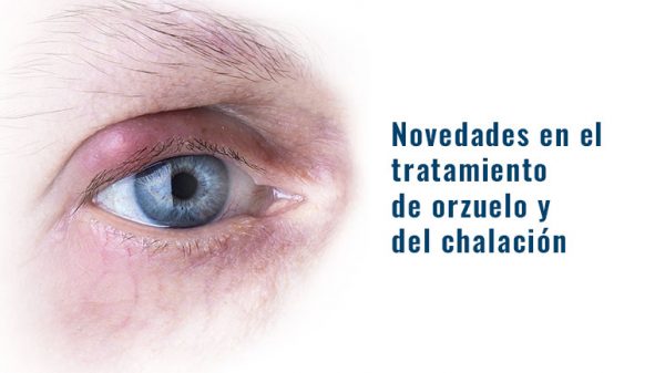 Tratamiento más efectivo para el Orzuelo - Chalación